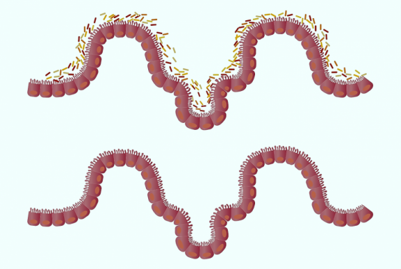 Plasmodesmos | Qué son, cómo se generan, cuándo surgen