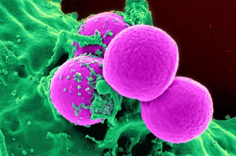 Protoplasto | Qué es, cómo se obtiene, usos