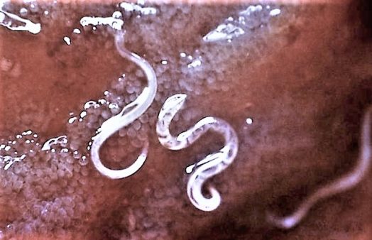 Nematelmintos | Qué son, características, clasificación, enfermedades