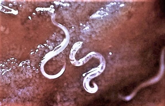 Nematelmintos | Qué son, características, clasificación, enfermedades